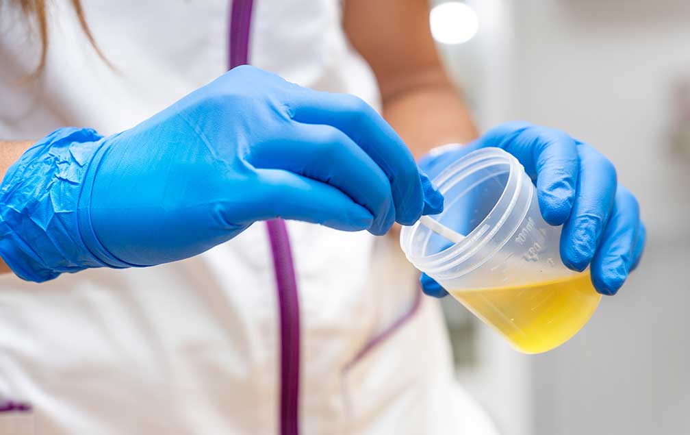 Proposed drug testing procedure requires 'observed' urine sample ...